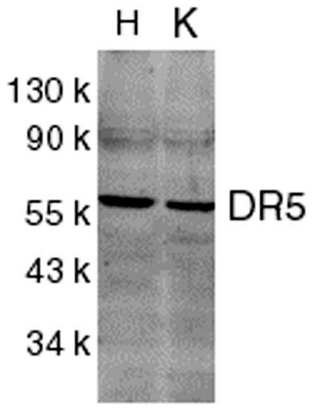Anti-DR5 Antibody, CT | AB16942